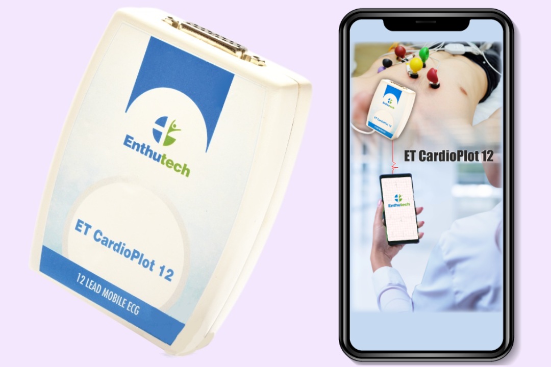 Pocket-Sized ECG Device Redefines Remote Cardiac Diagnosis